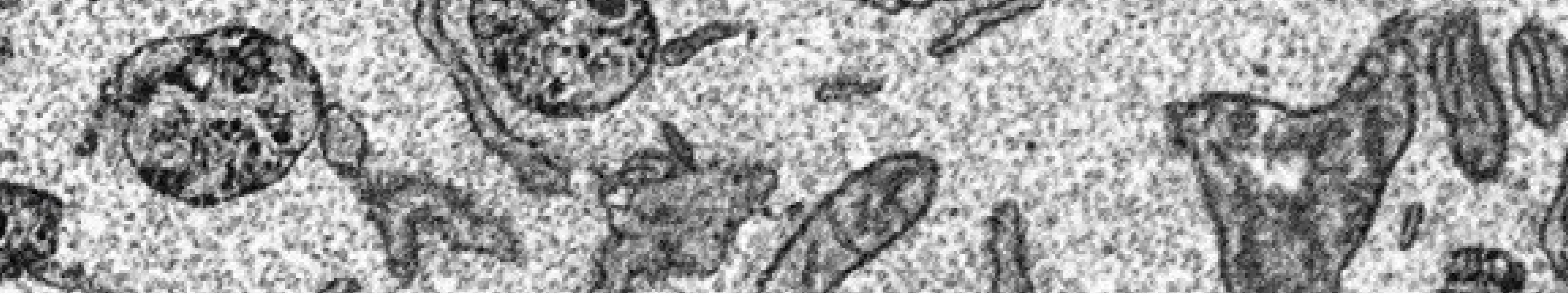 Tescan FIB-SEM for Life Science